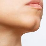 Dimple vs Cleft Chin: Unraveling the Myths